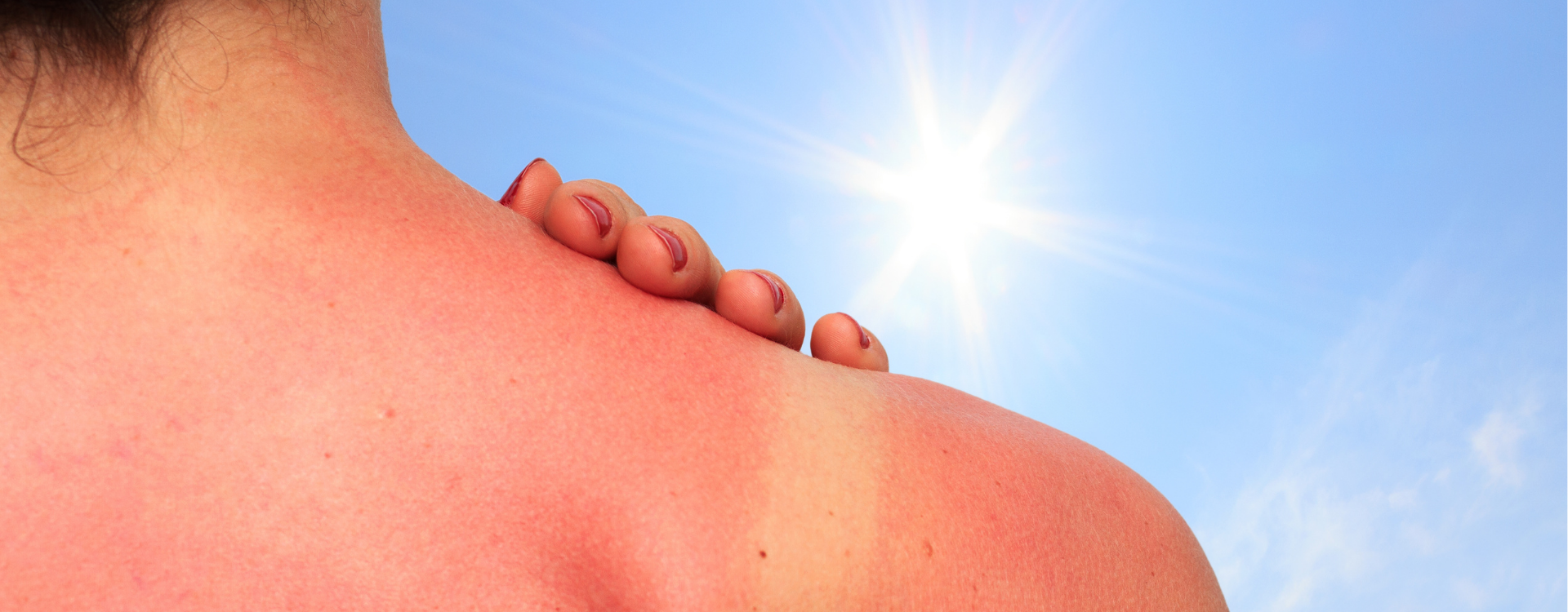 Tanning | Nevada Cancer Coalition