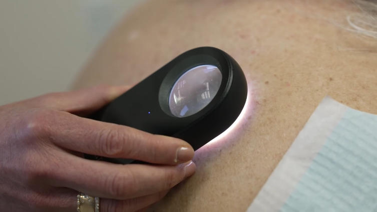 Success Story: Community Skin Check Clinic | Nevada Cancer Coalition