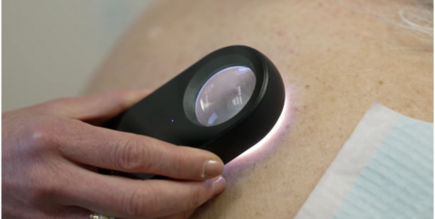 The Biggest Little Skin Cancer Screening Returns May 7 | Nevada Cancer ...